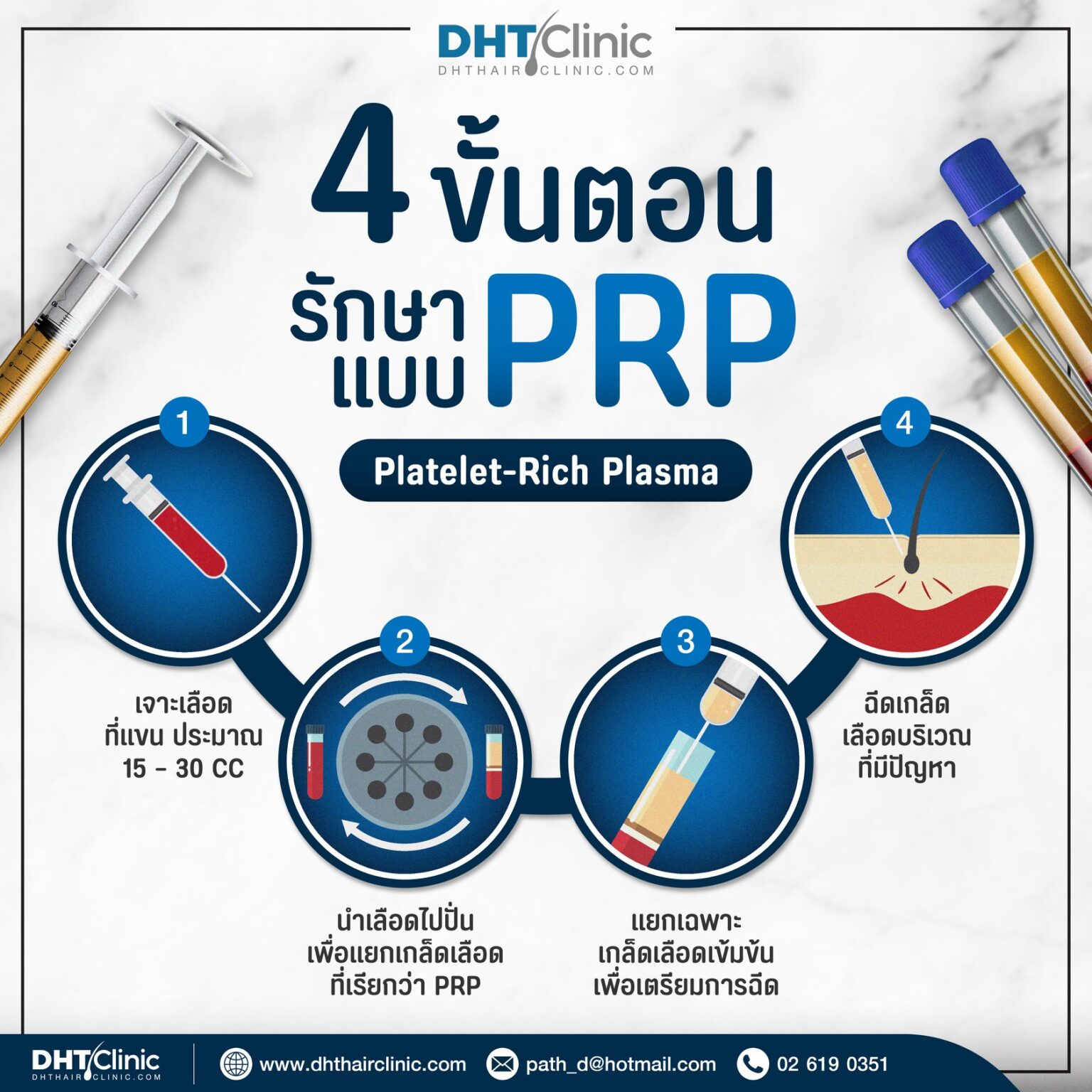 4 ขั้นตอน รักษาแบบ PRP (Platelet-Rich Plasma) มีอะไรบ้าง? – DHTClinic